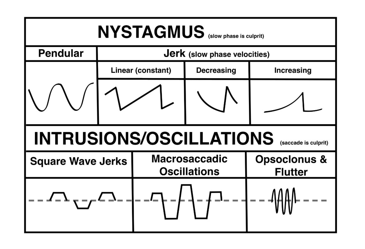1/ Opsoclonus myoclonus syndrome (OMS) – also known as “dancing eyes ...