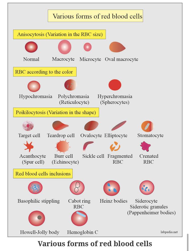 Anisocytosis