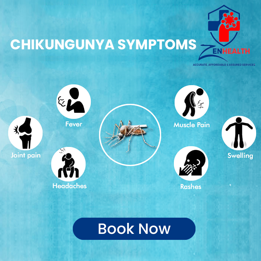 Chikungunya Rashes