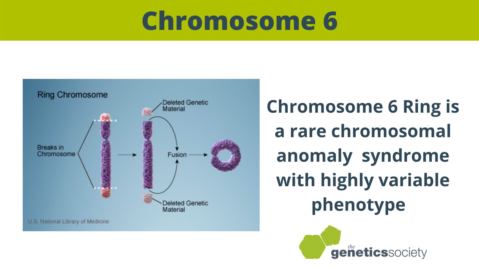 Ring Chromosome