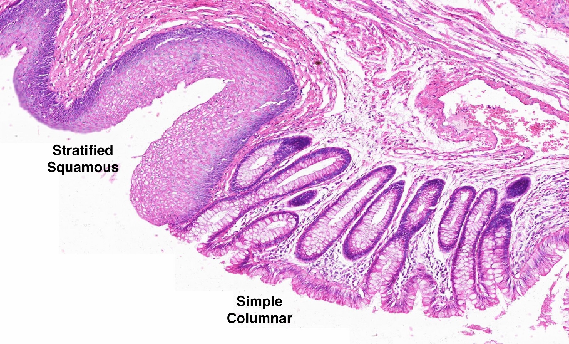 Rectoanal Junction Histology Labeled