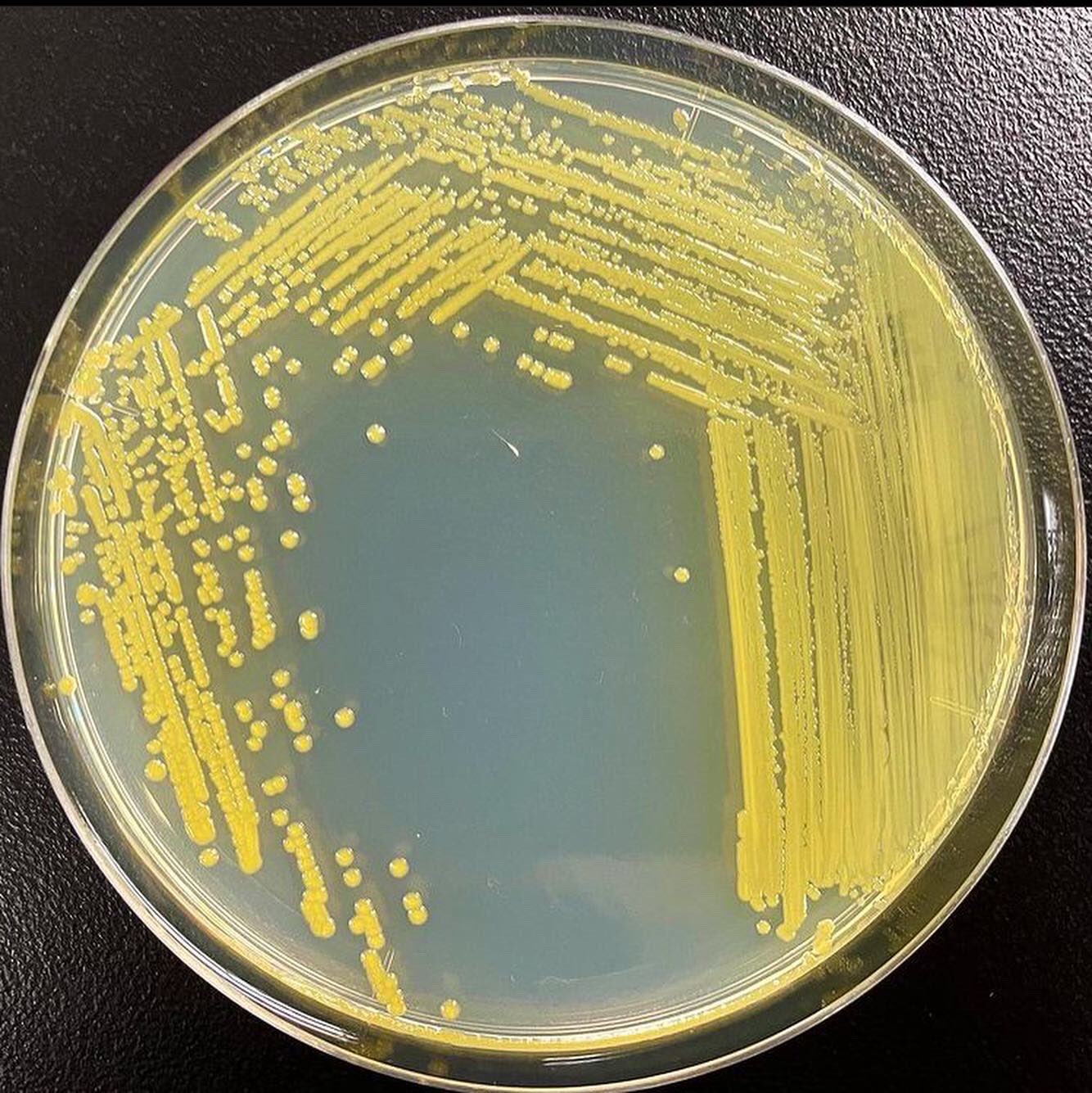 Pseudomonas Putida On Agar