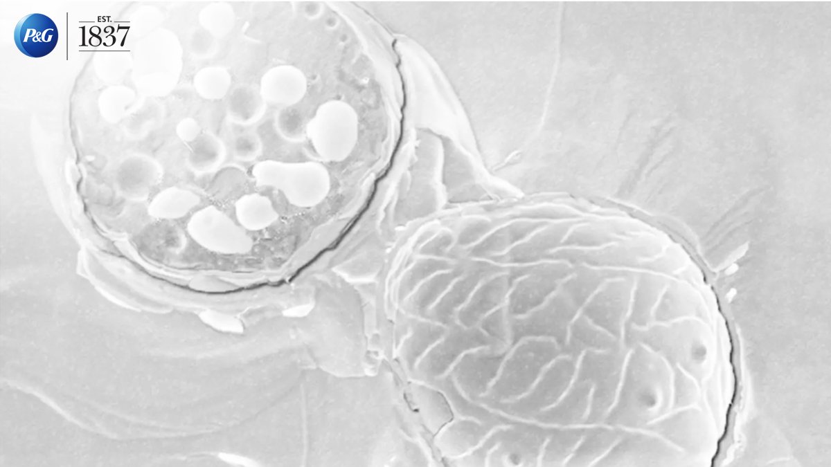 Dandruff Flake Under Microscope