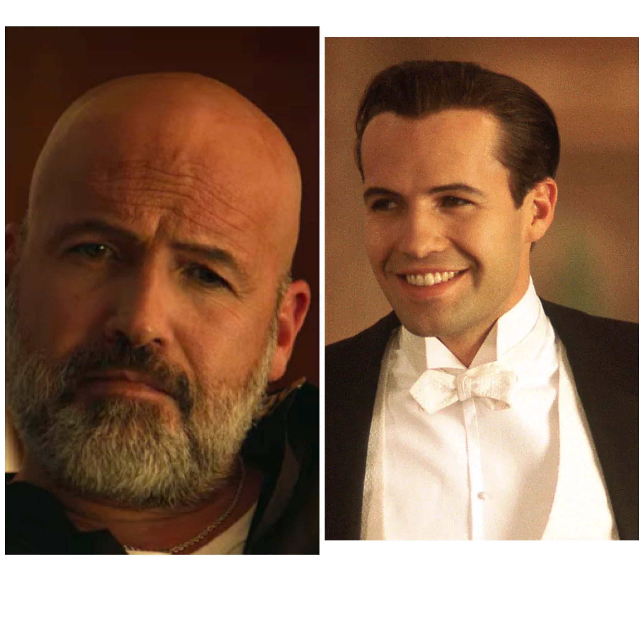 Billy Zane Hair Loss