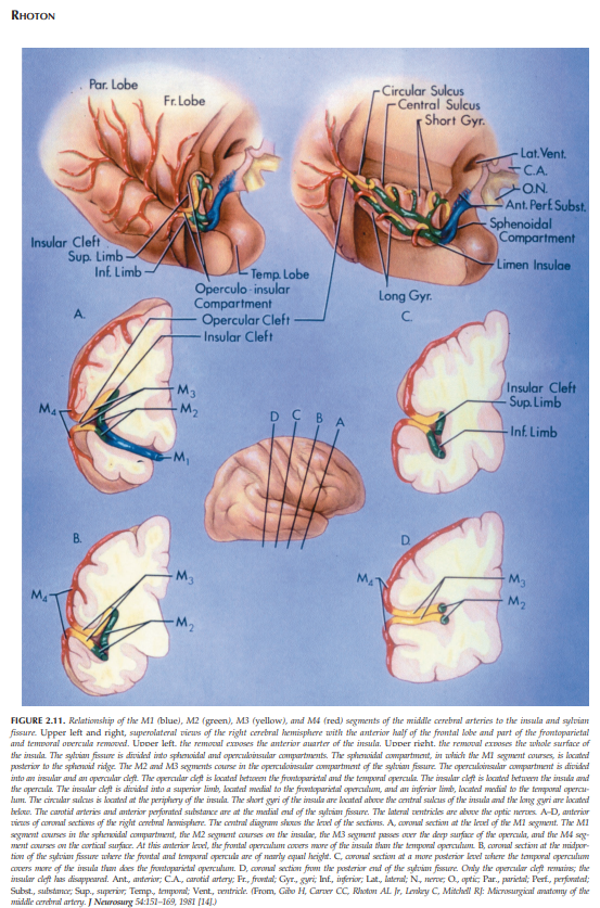 Where does the middle cerebral artery M1 segment become the M2 segment ...