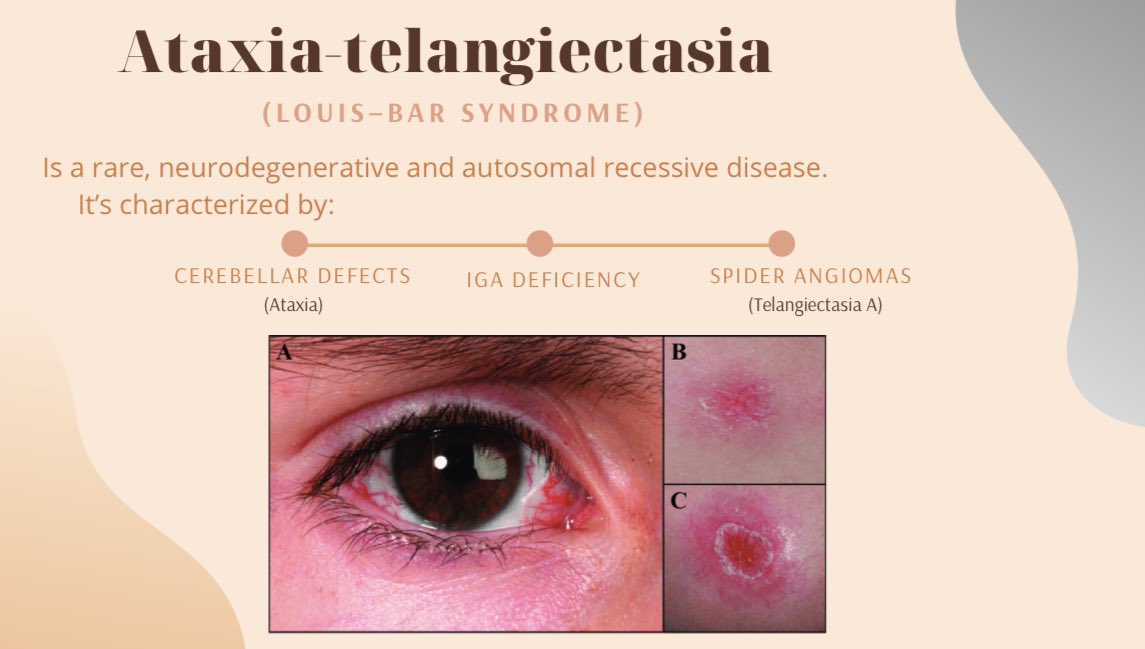 Ataxia Telangiectasia Skin