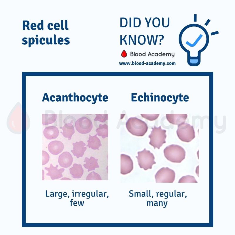 Echinocyte