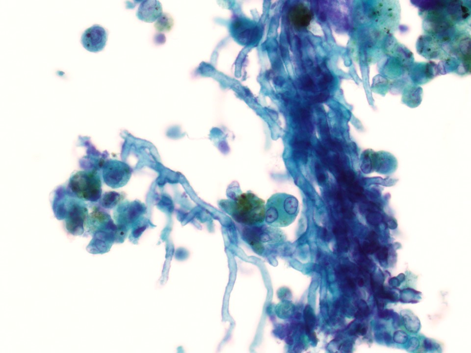 Aspergillus Fumigatus Hyphae