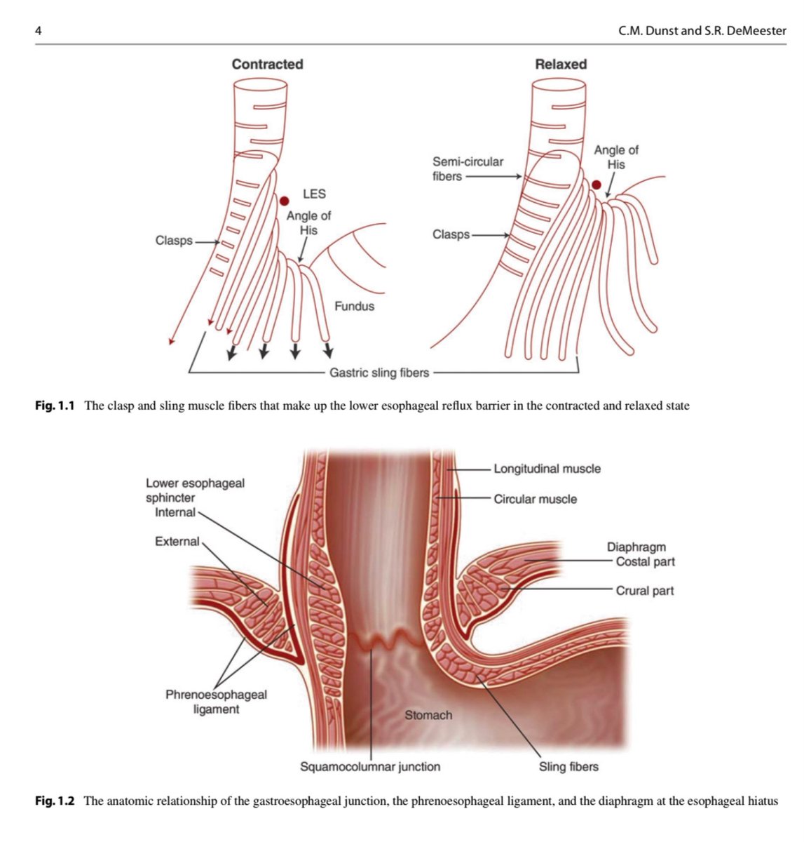 Lower Esophageal Sphincter Anatomy