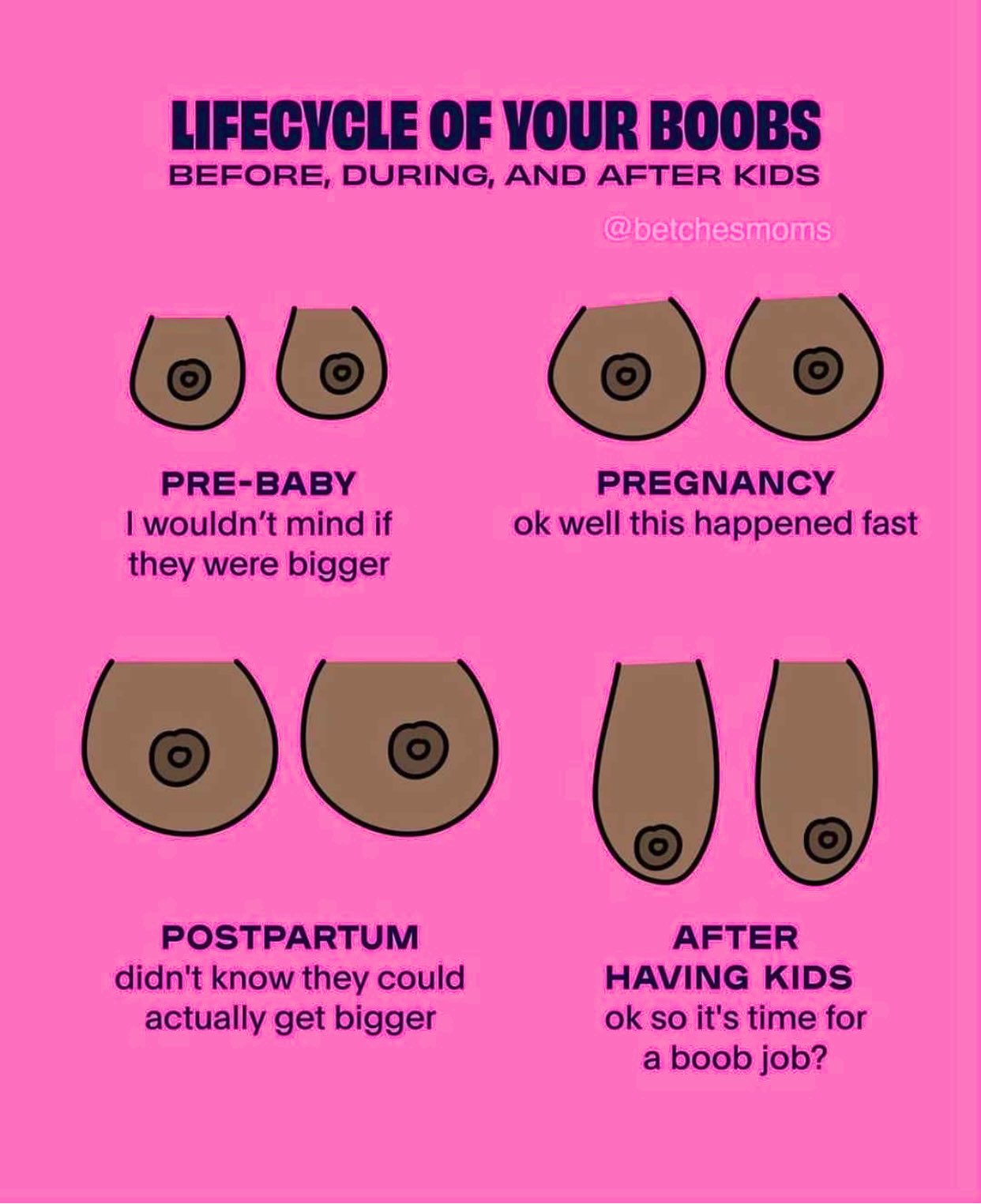 What Do Early Pregnancy Breasts Look Like