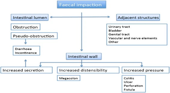 Fecal Impaction