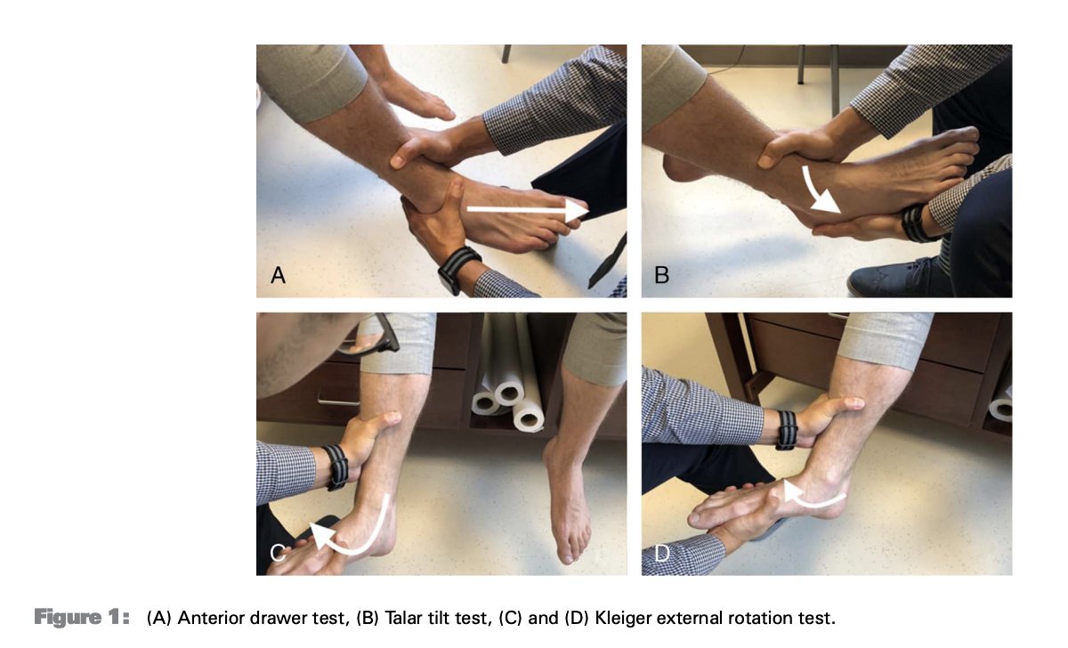 Kleigers Test For High Ankle Sprain Special Test For The 60 Off
