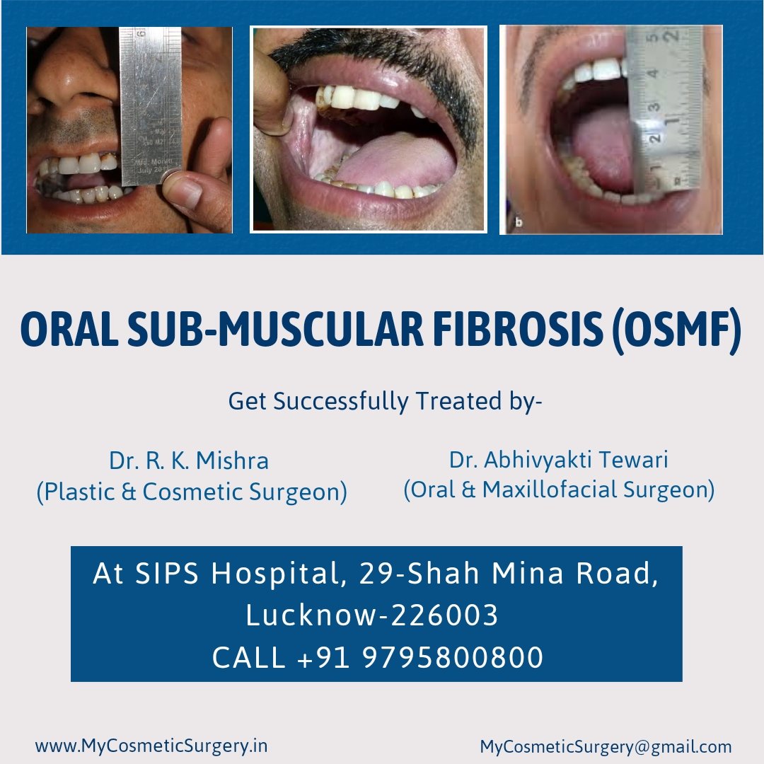 Oral Submucous Fibrosis