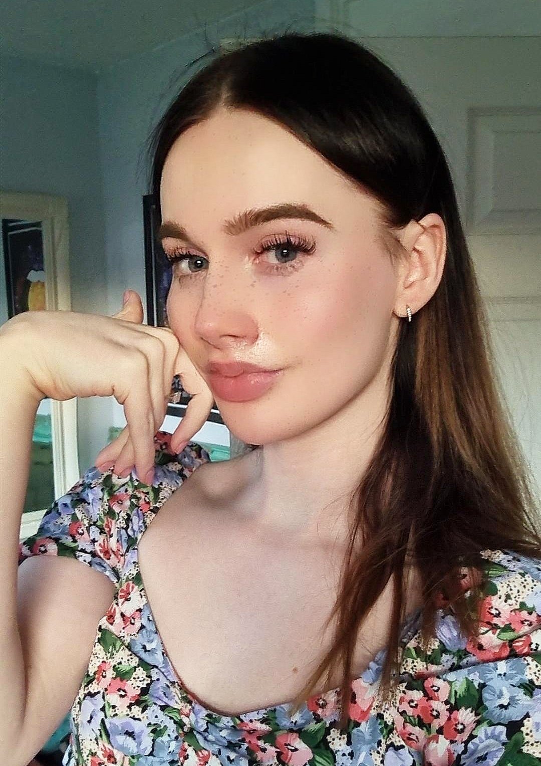 TW Pornstars - ALEXIS HEALY. Twitter. My first selfie post surgery, how's my lips?. 7:36 PM - 7 ...