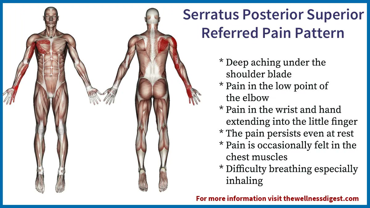 Serratus Posterior Trigger Point