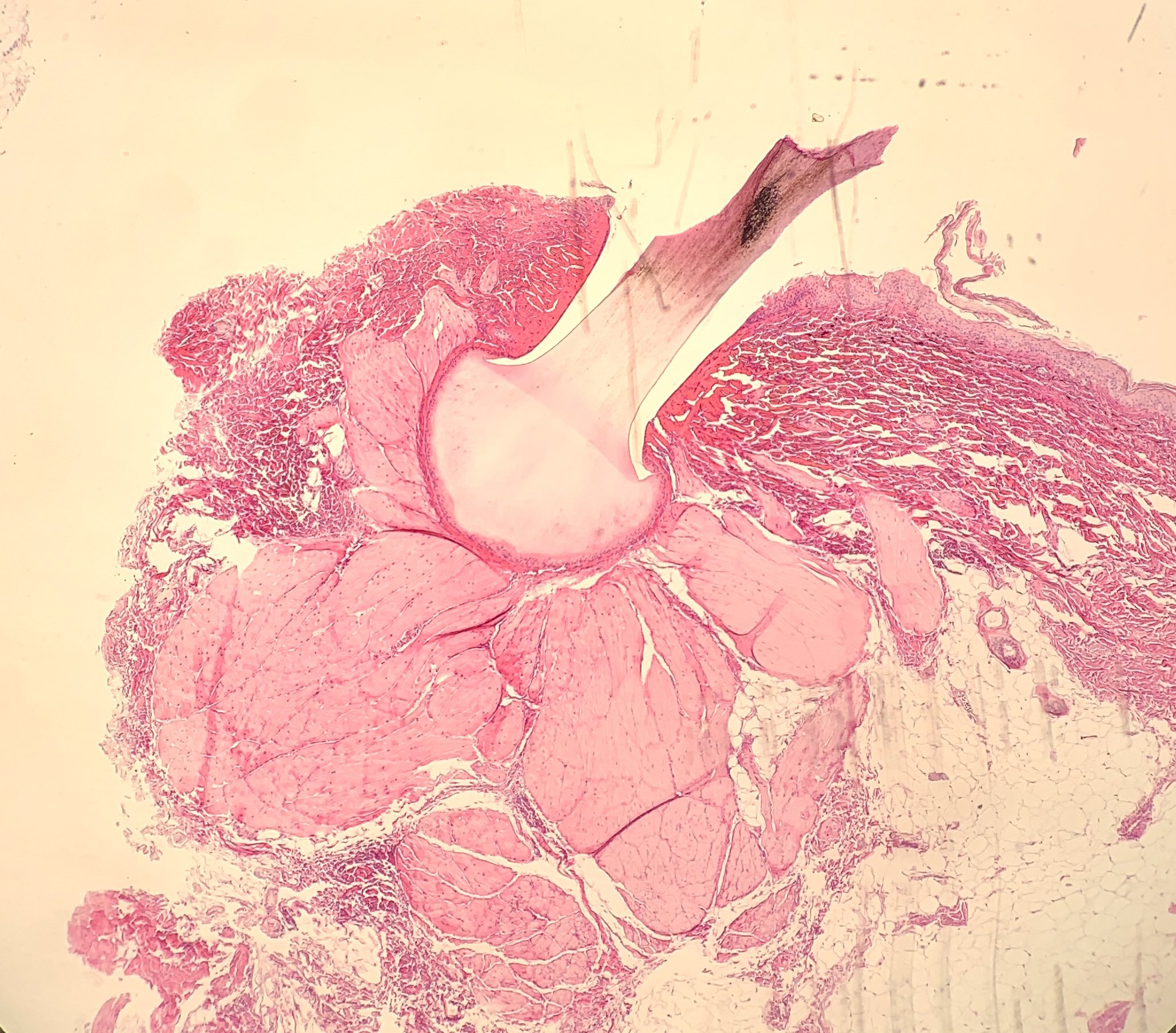 Piloerector Muscle Histology