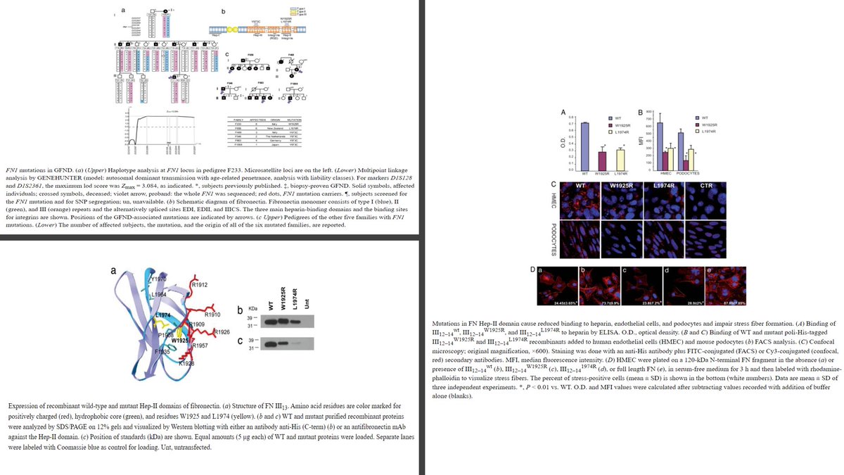 1/📢Hello #medtwitter This November's @ASPNeph Renal Pathology webinar ...