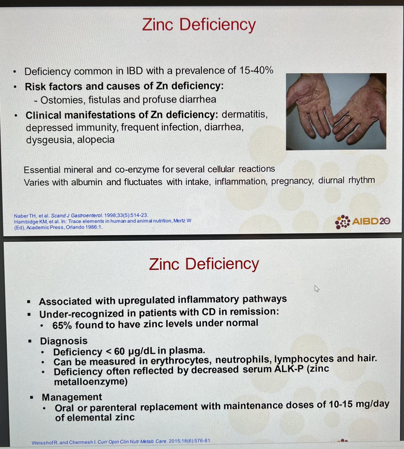 Zinc Deficiency In Humans