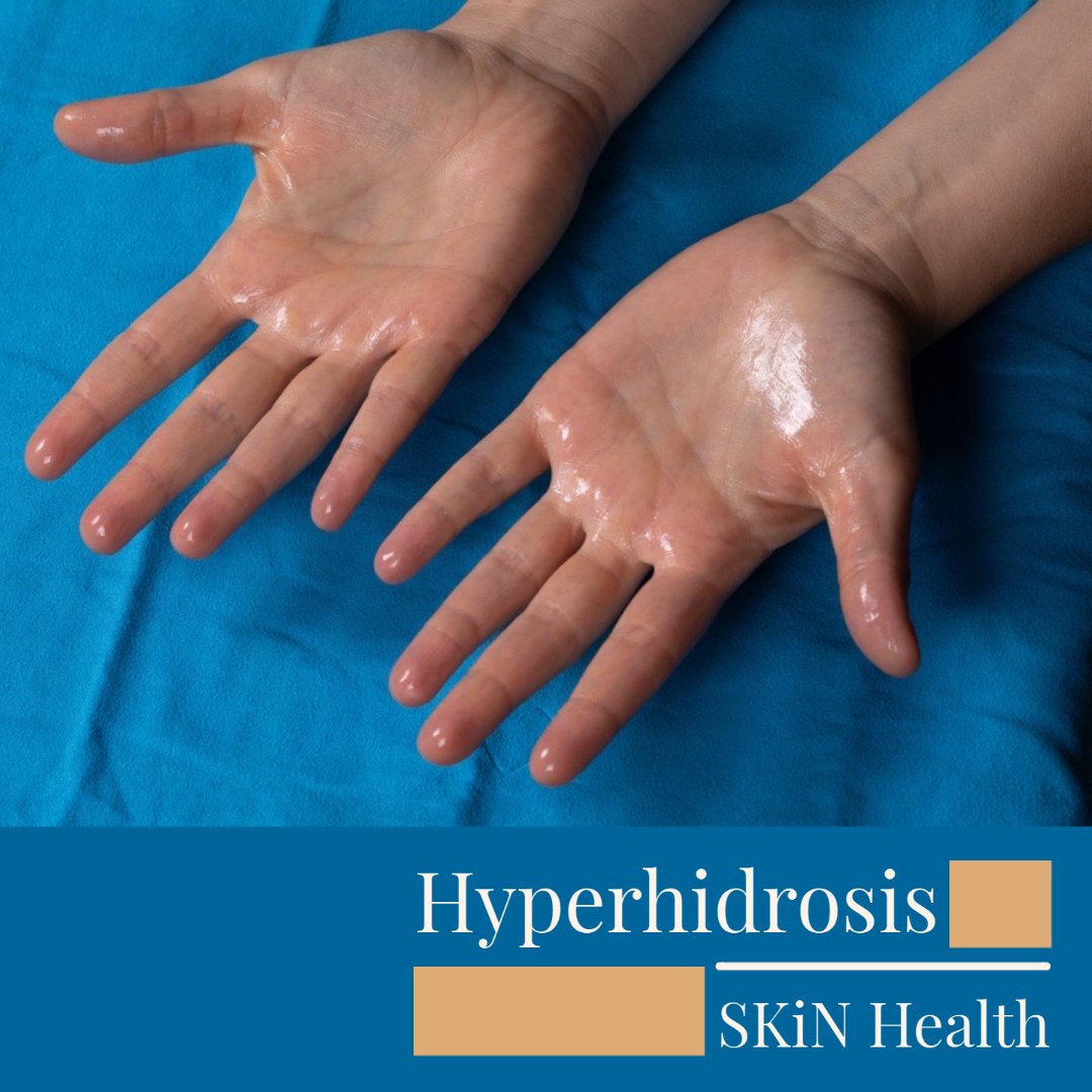 Hyperhidrosis Underarms