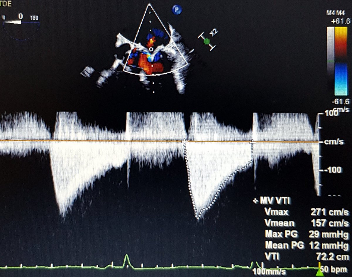 Thread by @dr_benoy_n_shah on Thread Reader App – Thread Reader App