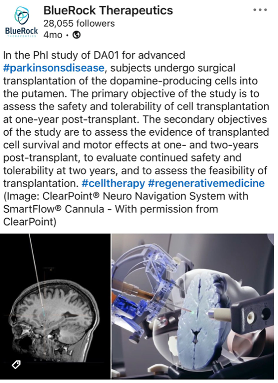 "Gene Editing in the Brain" Killer video with Dr. Niren Murthy (U Cal ...
