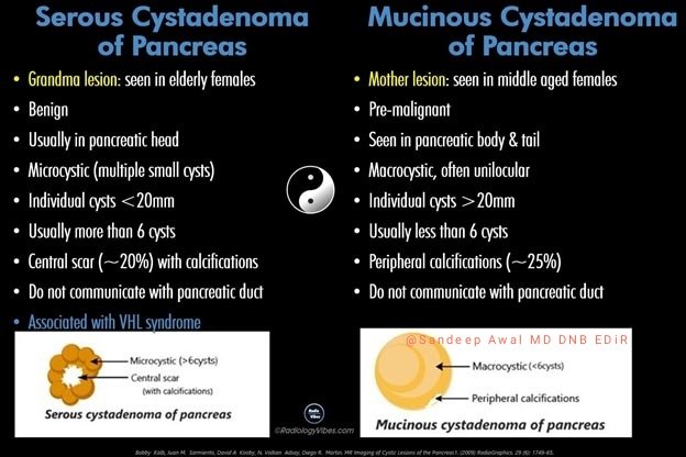 Mucinous Cystadenoma Pancreas
