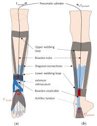 Dorsiflexion Of Wrist