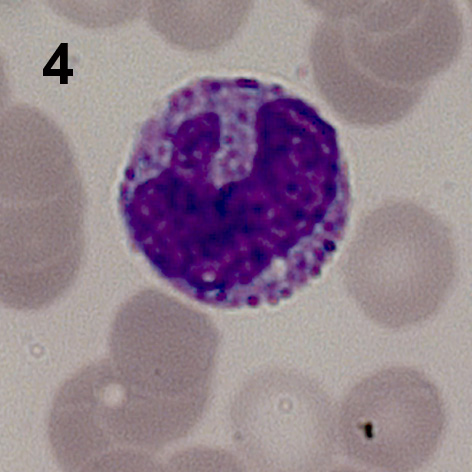 Alder Reilly Vs Toxic Granulation