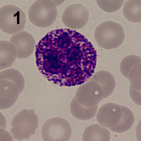 Alder Reilly Anomaly