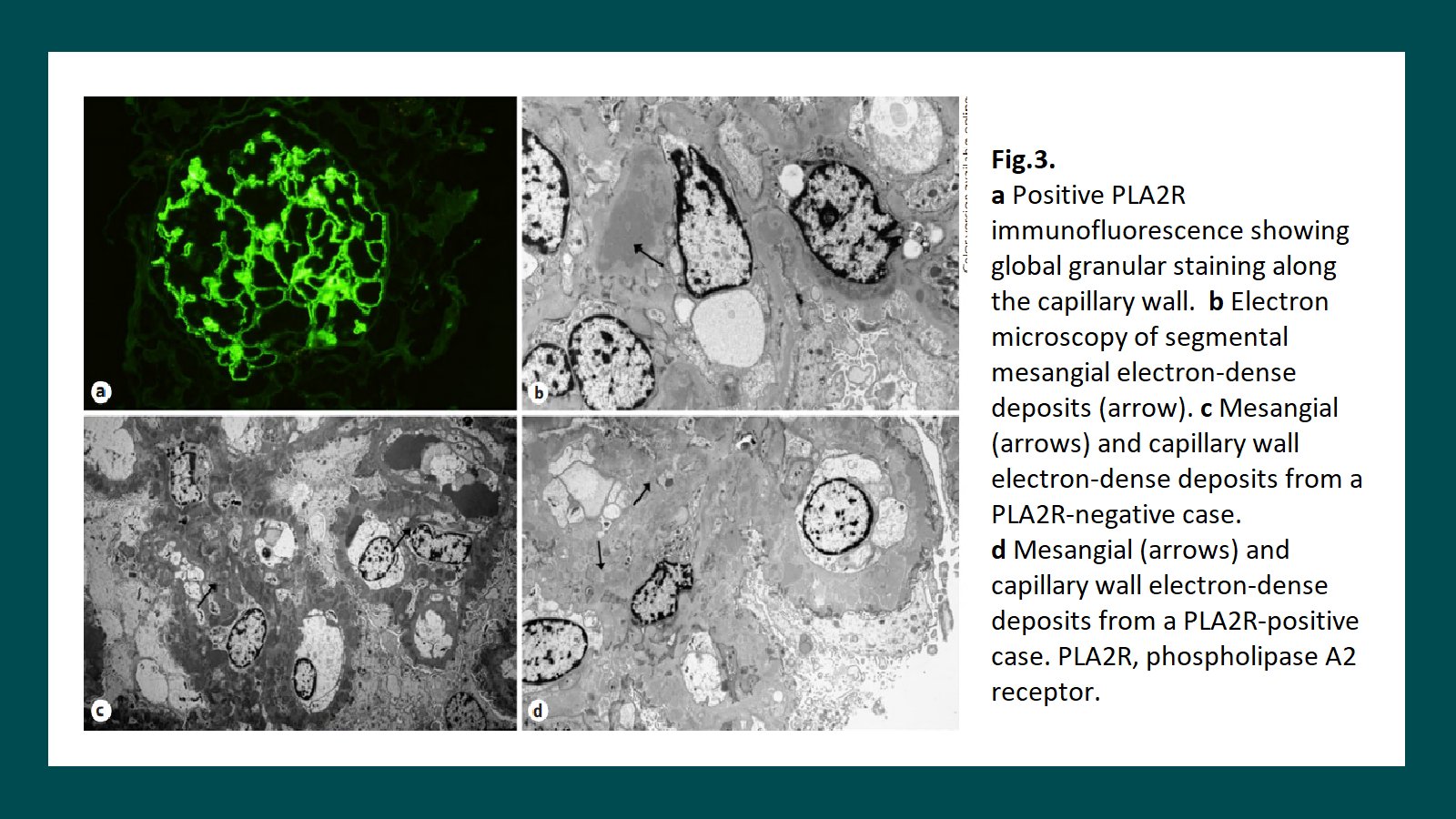 Is deposits negative or positive? Leia aqui: Is deposit a negative or ...