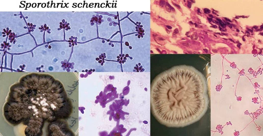 Images of Infectious Diseases Microbiology work up of synovial and ...