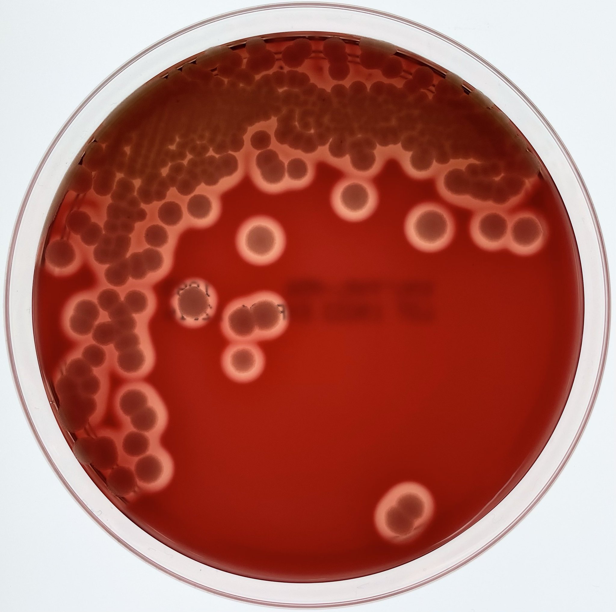 Bacillus Cereus Mannitol Salt Agar