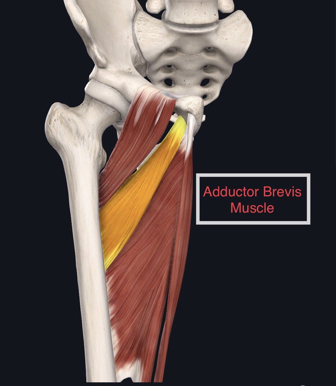 Right Adductor Strain