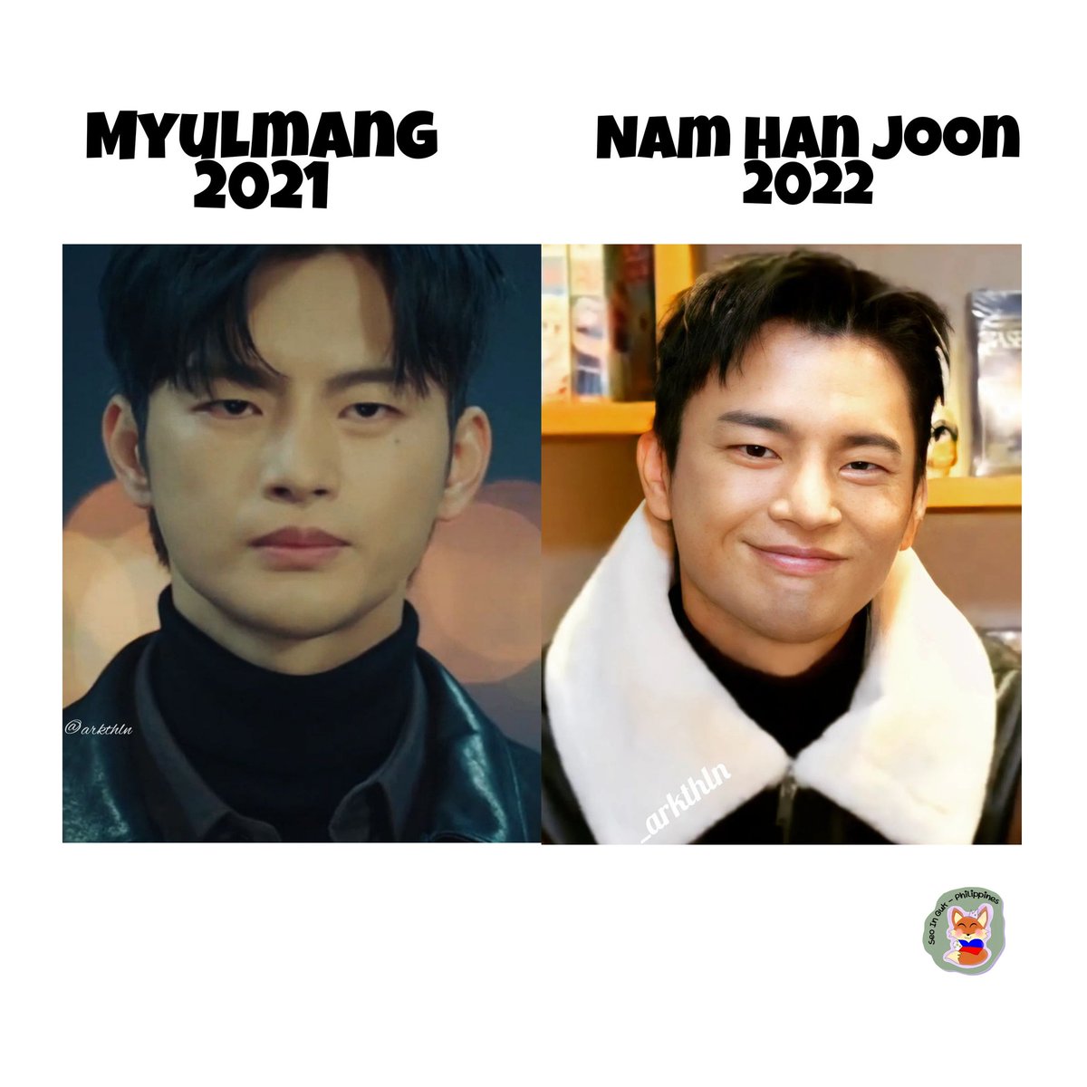 Seo In Guk Plastic Surgery