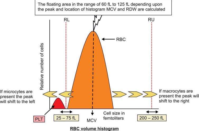 شرح مختصر ال (RBC histogram) لدكتور ابراهيم حداد 👍 (اتمنى لكم قراءة ...