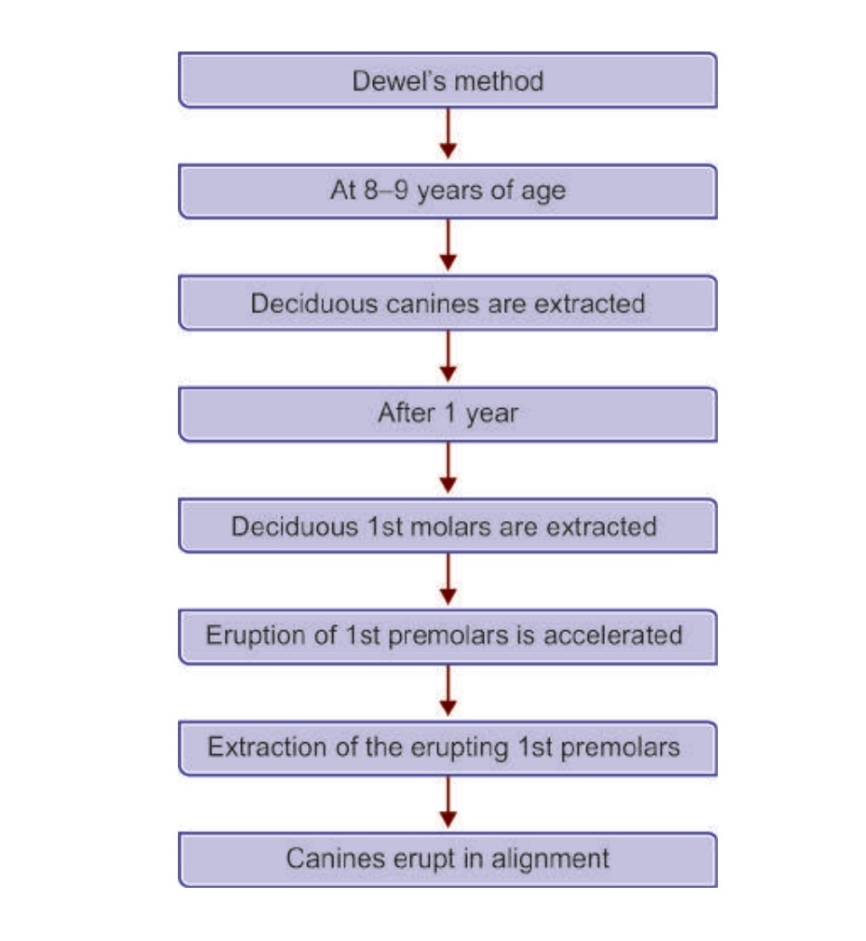 Serial extraction #Dental_by_Hadeel - Thread from هديل 🕊 @Hadeel7m ...