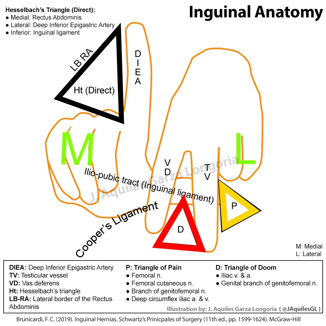 Triangle Of Doom And Pain