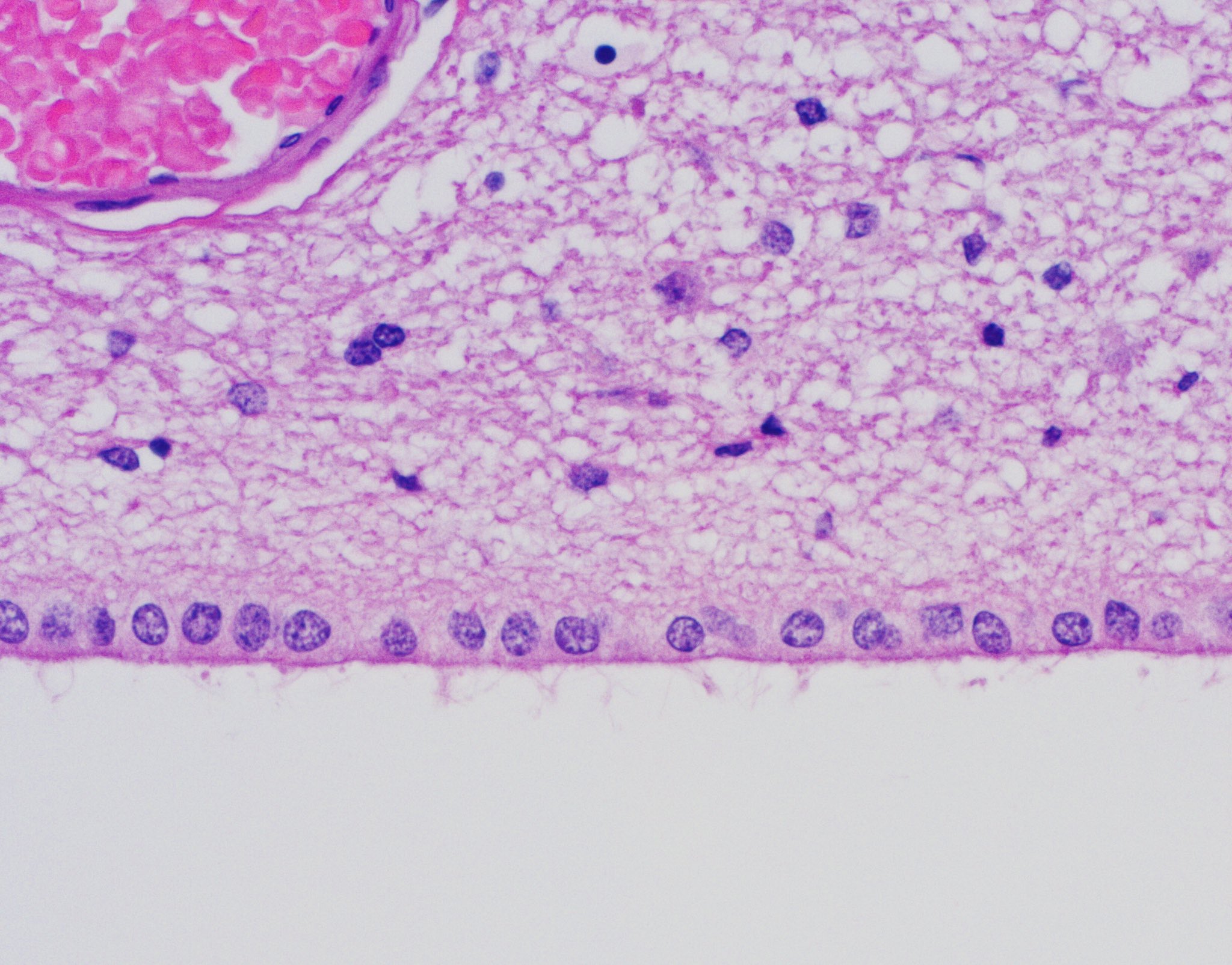 Ependymal Cells Histology