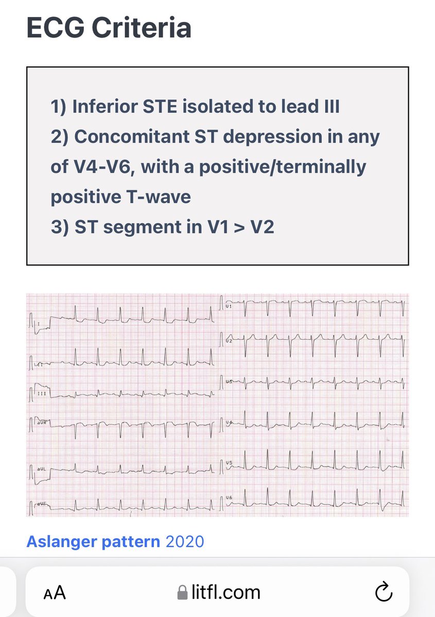 Let’s thread-together-ECG cheat sheets. Beginning from this masterpiece ...