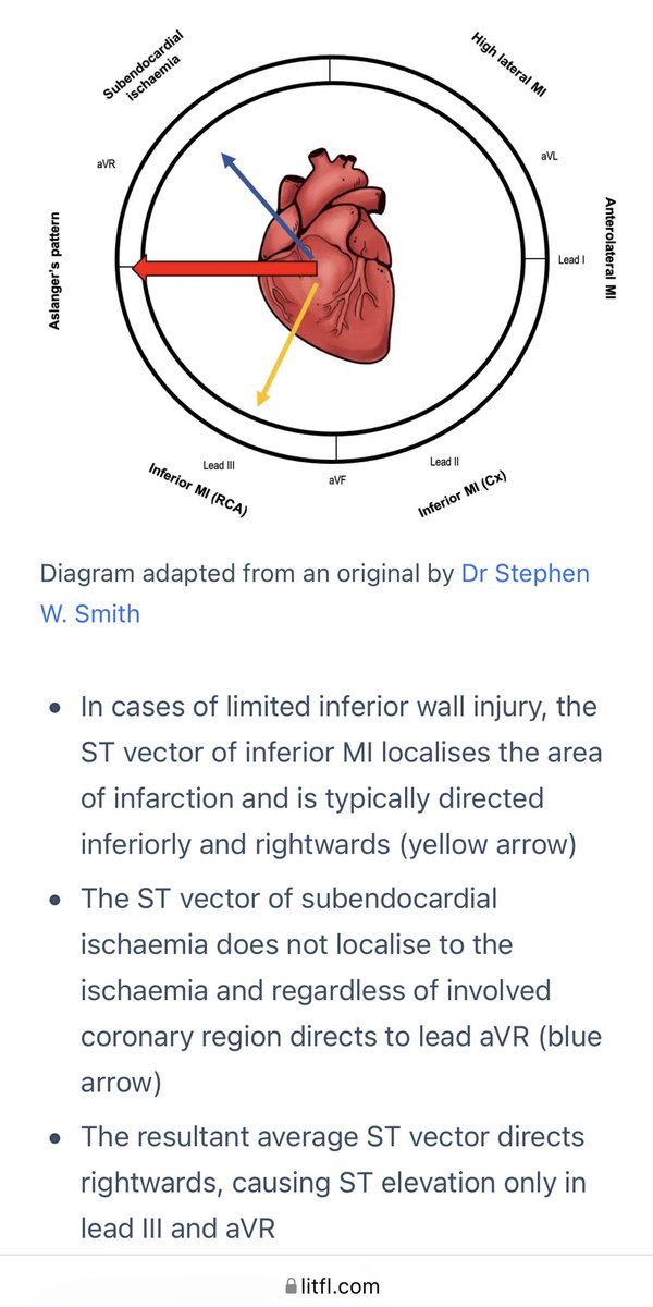 Let’s thread-together-ECG cheat sheets. Beginning from this masterpiece ...