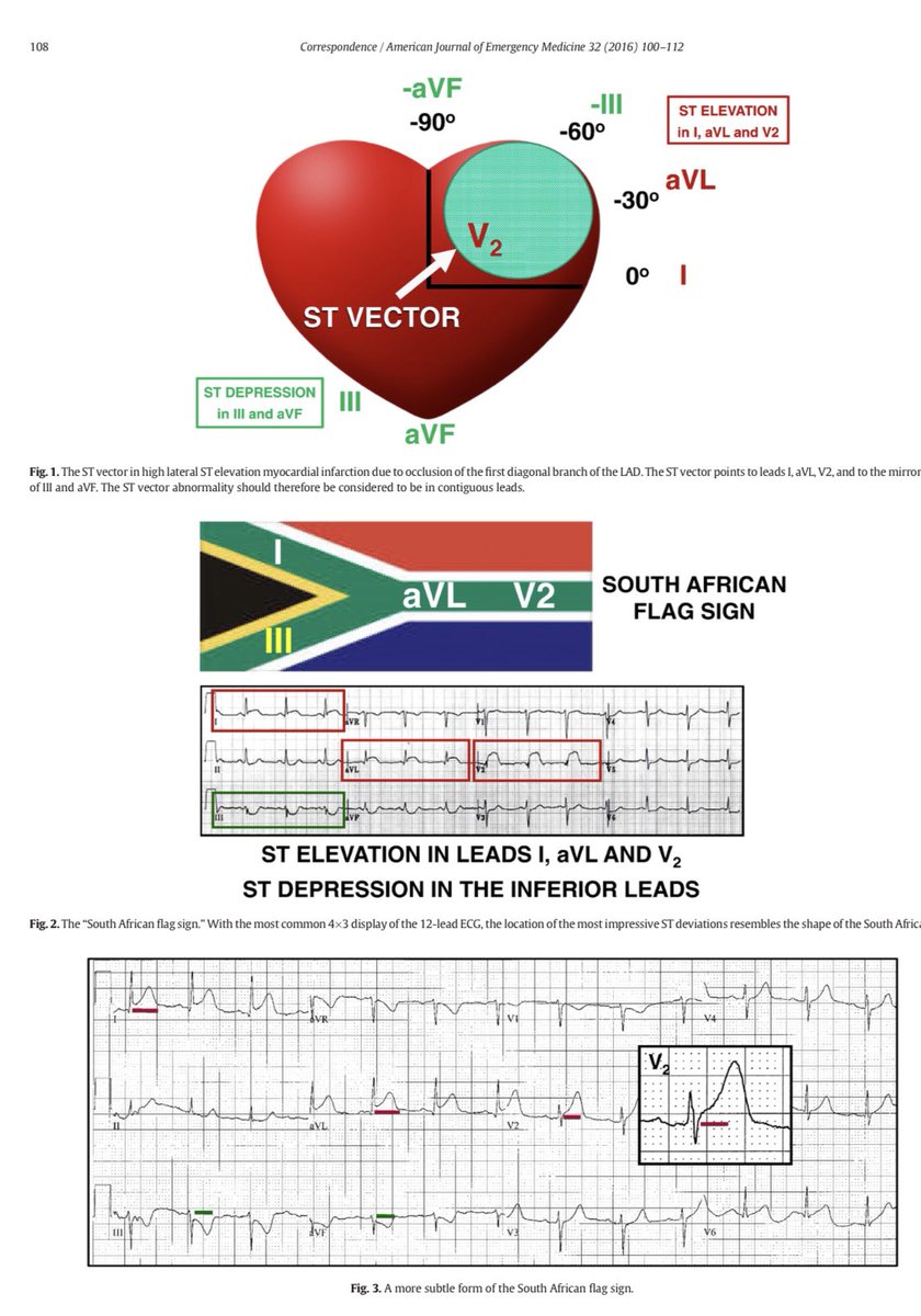 Let’s thread-together-ECG cheat sheets. Beginning from this masterpiece ...