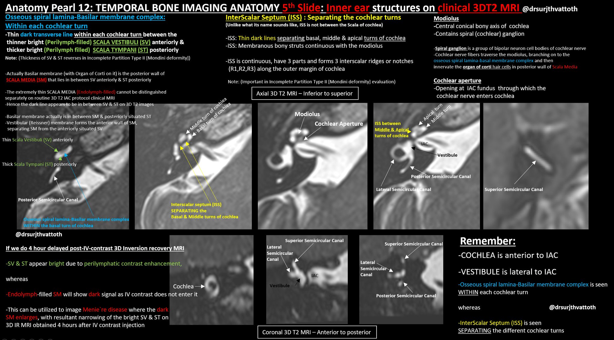 Iac Mri Anatomy The Oculomotor Cistern: Anatomy And High Resolution