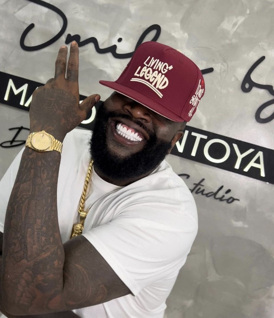 Rick Ross Before And After 2022