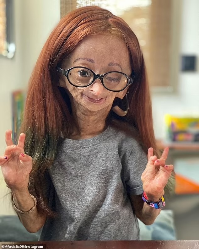 Progeria Adalia Rose 2022