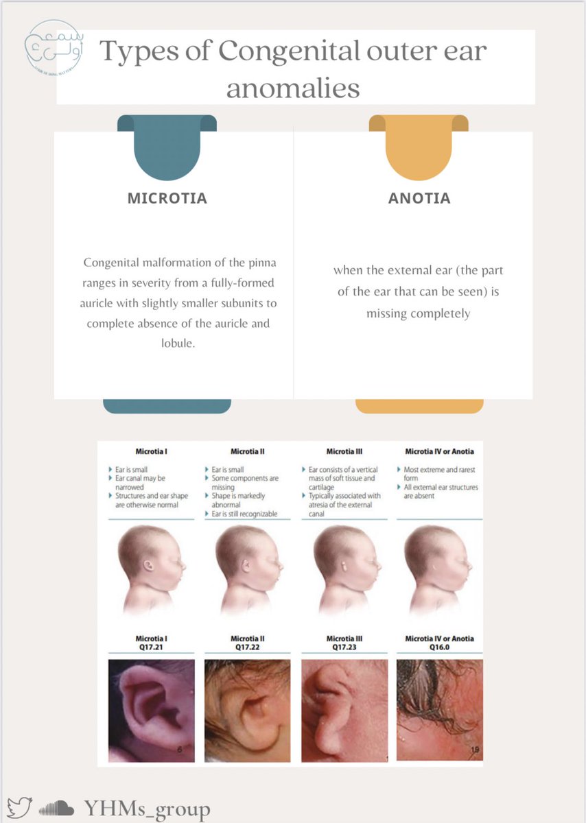 Hello everyone, Happy rainy Saturday 💡! Today we will talk about a very ...