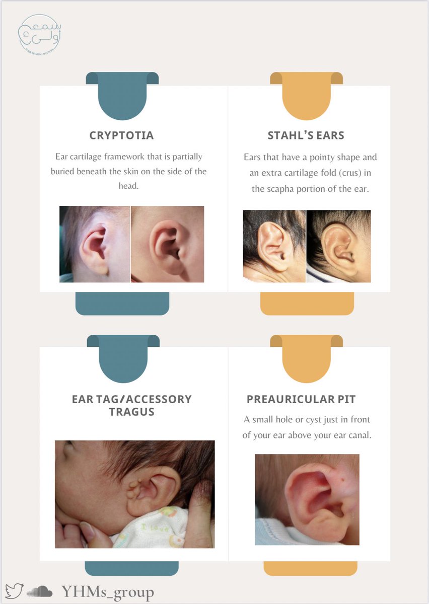 Hello everyone, Happy rainy Saturday 💡! Today we will talk about a very ...