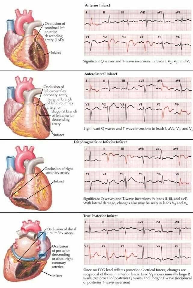 Coronary Arteries Netter