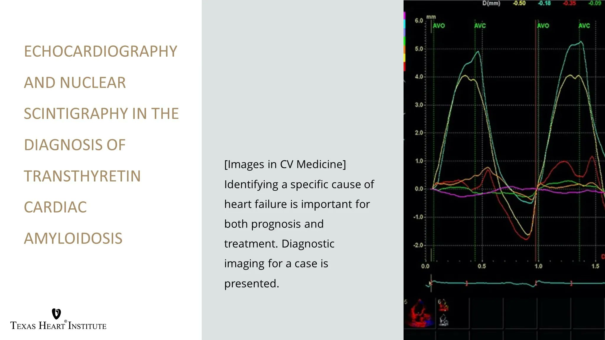 Baylor Med Adv Heart Failure & Structural Heart (@BCMAdvStrlHeart) / Twitter