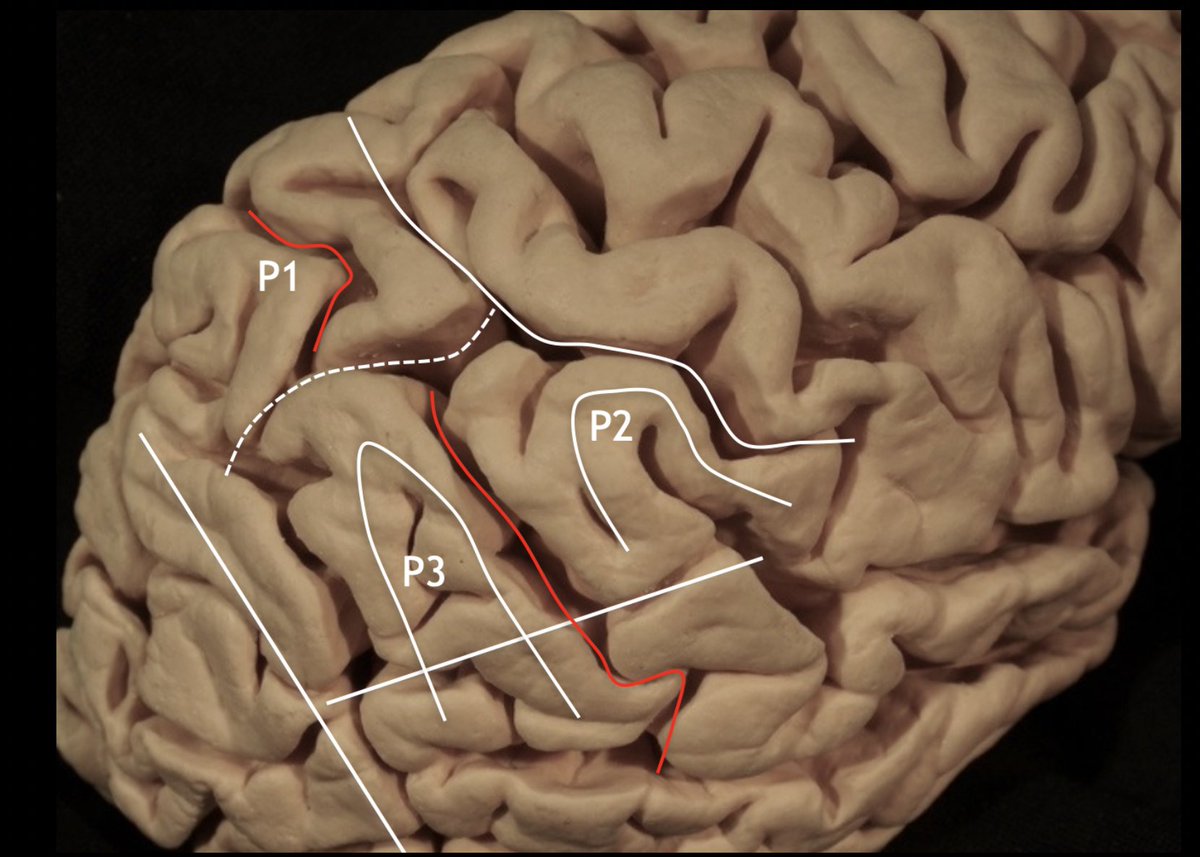 Intraparietal Sulcus Location