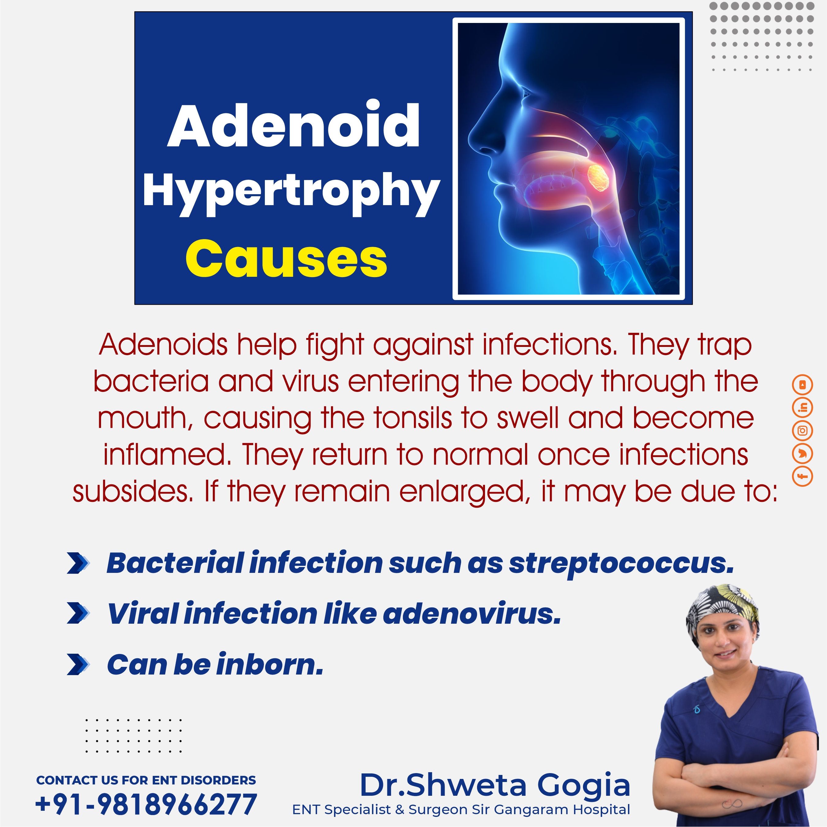 Adenoid Hypertrophy In Adults